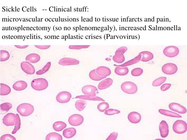 PPT - Normal Red Blood Cells - Peripheral Blood Smear PowerPoint ...