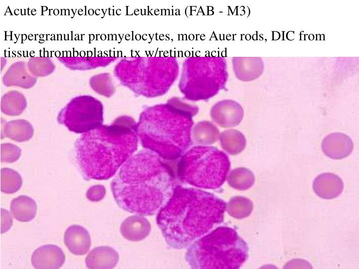 PPT - Normal Red Blood Cells - Peripheral Blood Smear PowerPoint ...