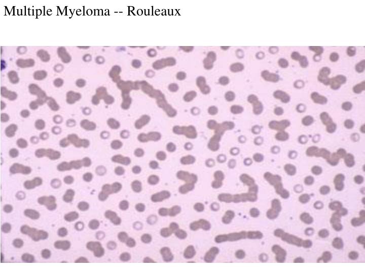 PPT - Normal Red Blood Cells - Peripheral Blood Smear PowerPoint ...