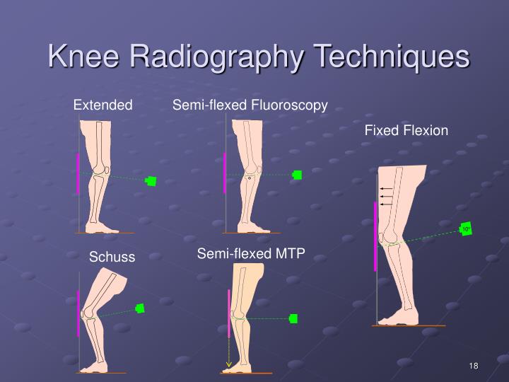 PPT - Osteoarthritis (OA): in vitro and animal models PowerPoint ...