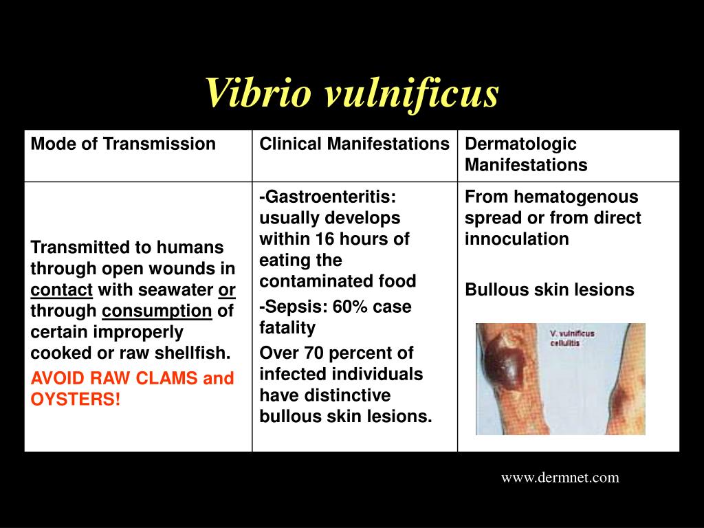 PPT - Opportunistic Infections: for VCU Medical Residents- Noon ...