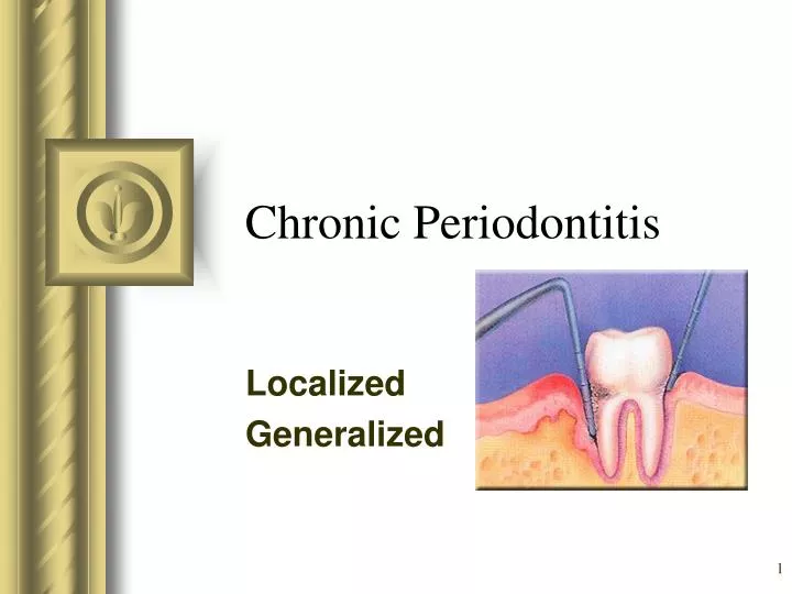 PPT - Chronic Periodontitis PowerPoint Presentation, free download - ID ...