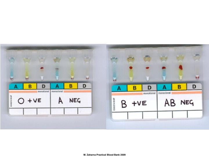 PPT - Blood Grouping Slide & Tube Methods PowerPoint Presentation - ID ...