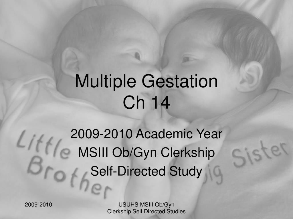 Ppt Multiple Gestation Ch 14 Powerpoint Presentation Free Download