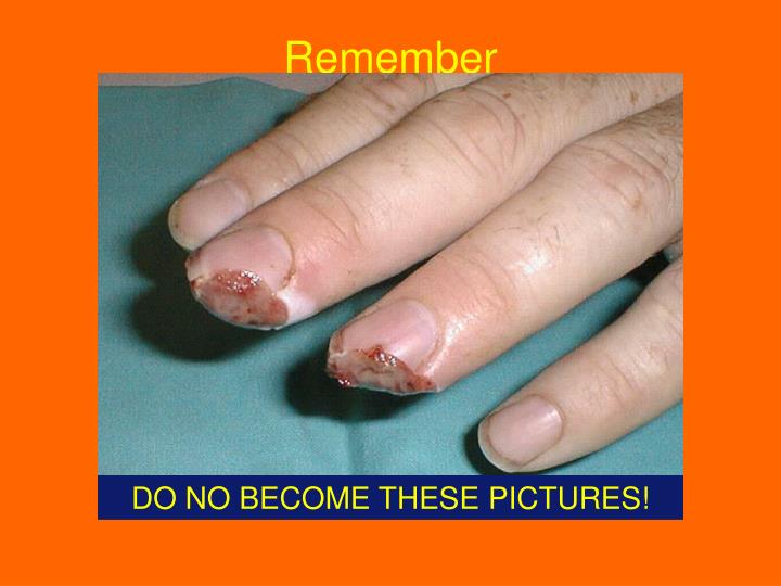 PPT - Hand tools injury prevention PowerPoint Presentation - ID:358836