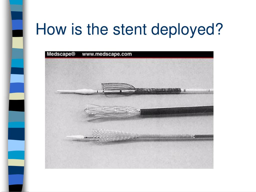 PPT - Metal Stents in Gastroenterology Kirsten Rosser, RN ...