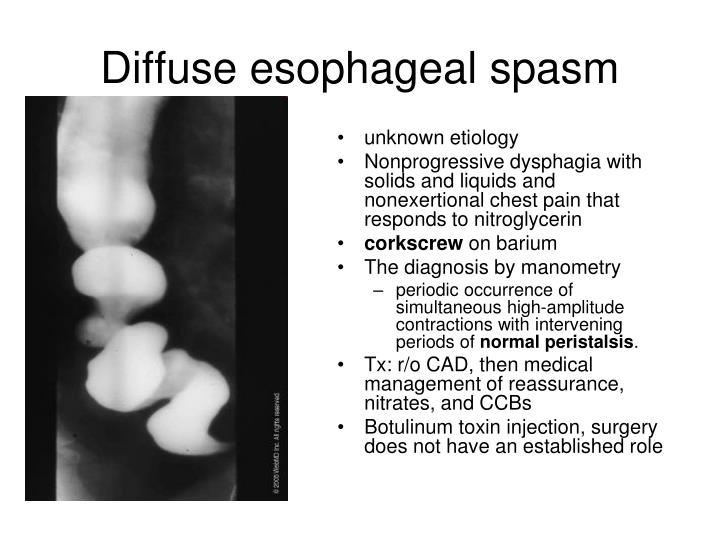 PPT - GERD/Barrett's Esophagus, Dysphagia, Hiatal Hernia, and ...