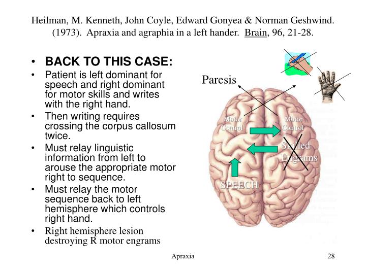 PPT - Apraxia PowerPoint Presentation - ID:363535