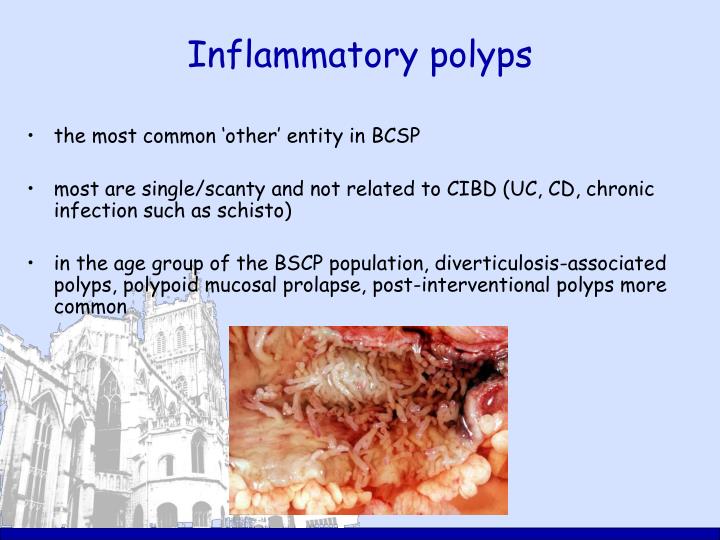 PPT - Special polyp types PowerPoint Presentation - ID:364945