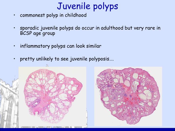 PPT - Special polyp types PowerPoint Presentation - ID:364945