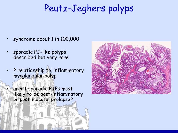 PPT - Special polyp types PowerPoint Presentation - ID:364945