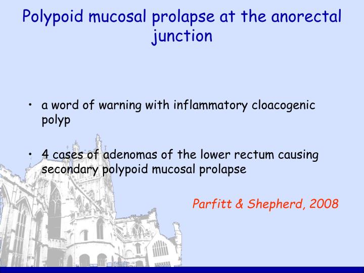 PPT - Special polyp types PowerPoint Presentation - ID:364945