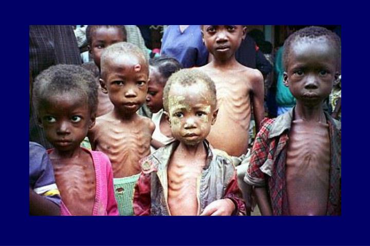 PPT - Protein Energy Malnutrition (PEM) in Children PowerPoint ...