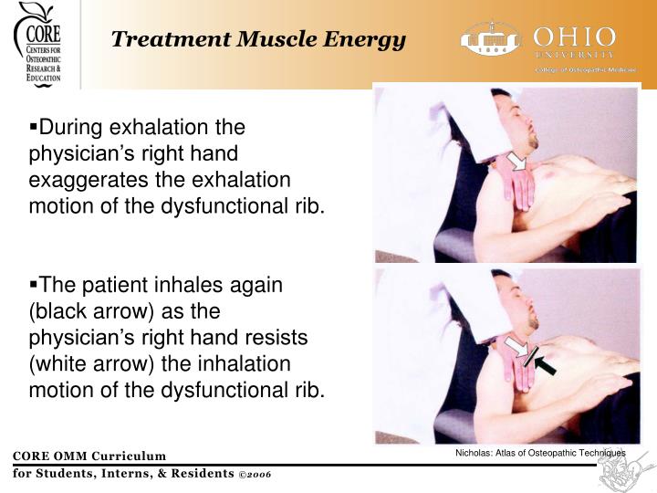 PPT - Costochondritis PowerPoint Presentation - ID:371208