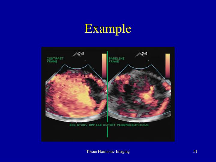 PPT - Ultrasonic Nonlinear Imaging- Tissue Harmonic Imaging PowerPoint ...