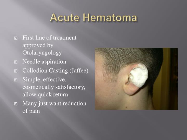 PPT - Management of Auricular Hematoma PowerPoint Presentation - ID:372352
