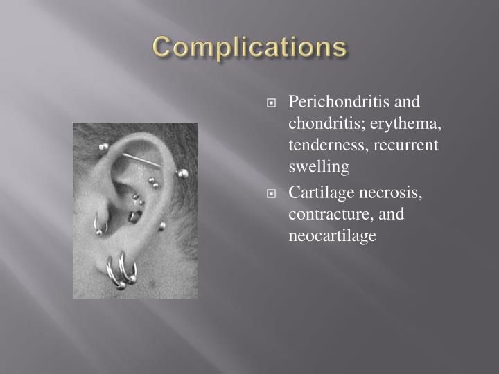 PPT - Management of Auricular Hematoma PowerPoint Presentation - ID:372352