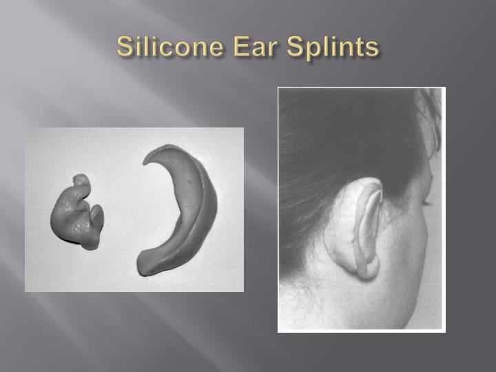 PPT - Management of Auricular Hematoma PowerPoint Presentation - ID:372352