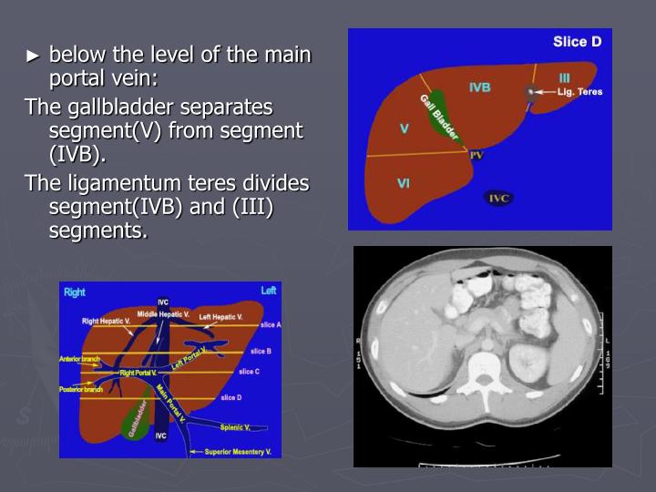 PPT - What is The LIVER ? PowerPoint Presentation - ID:373722