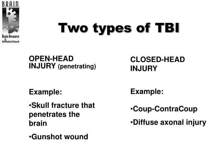 PPT - Brain Injury 101 PowerPoint Presentation - ID:374722