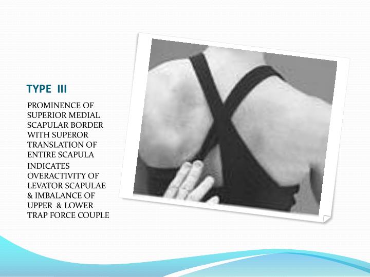 PPT - SCAPULAR DYSKINESIS & ITS RELATION TO SHOULDER PAIN PowerPoint ...