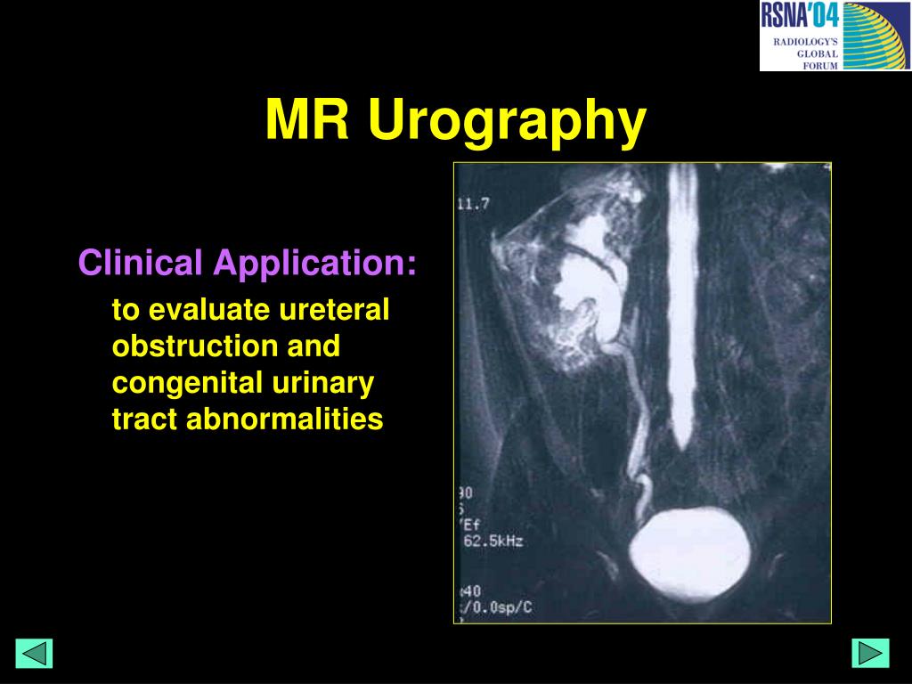 Ppt Mri Atlas Of Renal Pathology Powerpoint Presentation Free