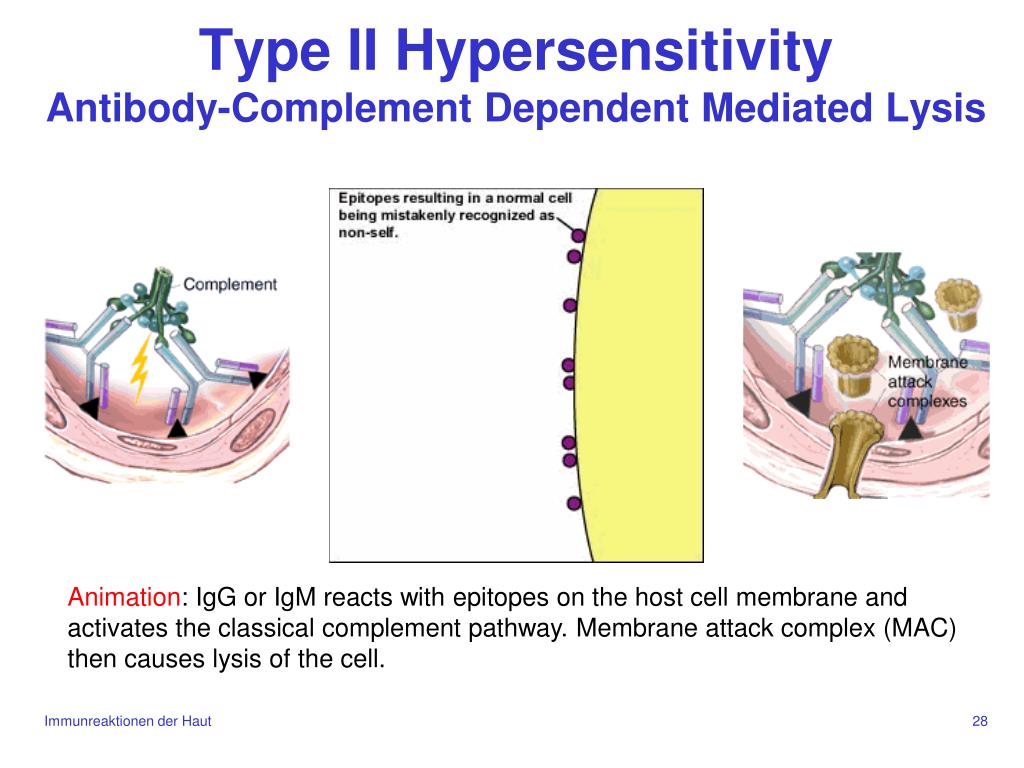 PPT - Fachpraktikum Immunreaktionen der Haut PowerPoint Presentation ...