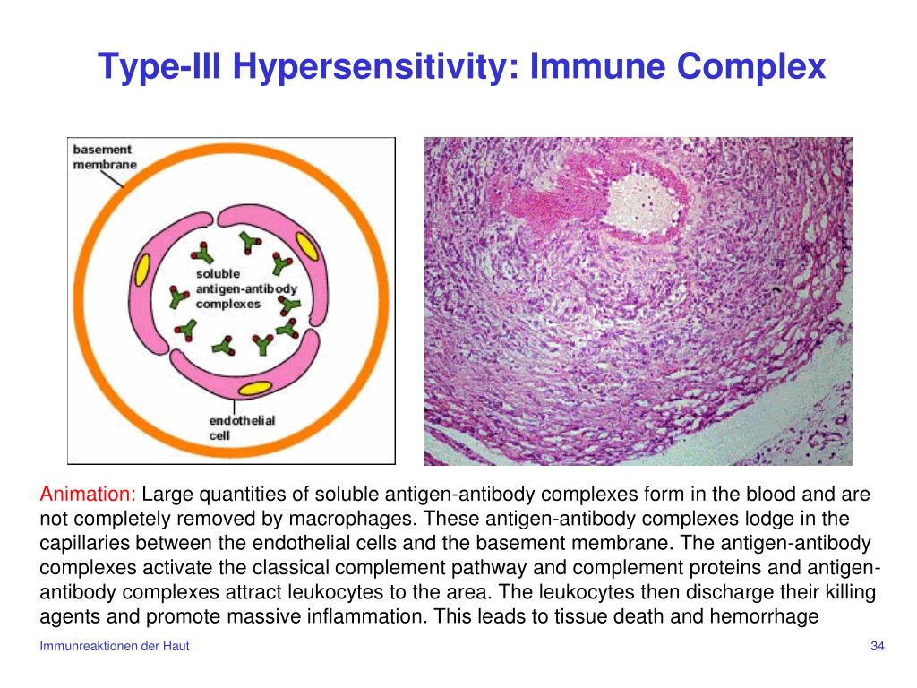 PPT - Fachpraktikum Immunreaktionen der Haut PowerPoint Presentation ...