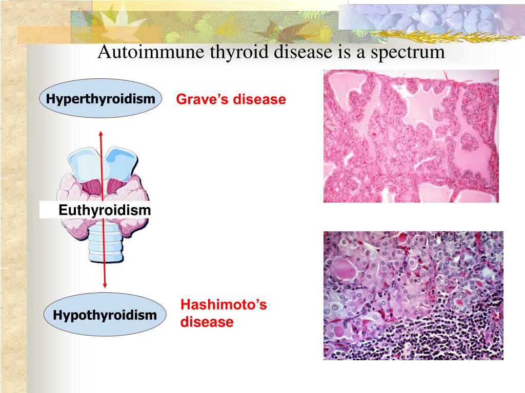 PPT - Nuclear Medicine in Endocrinology (Thyroid Diseases) PowerPoint ...