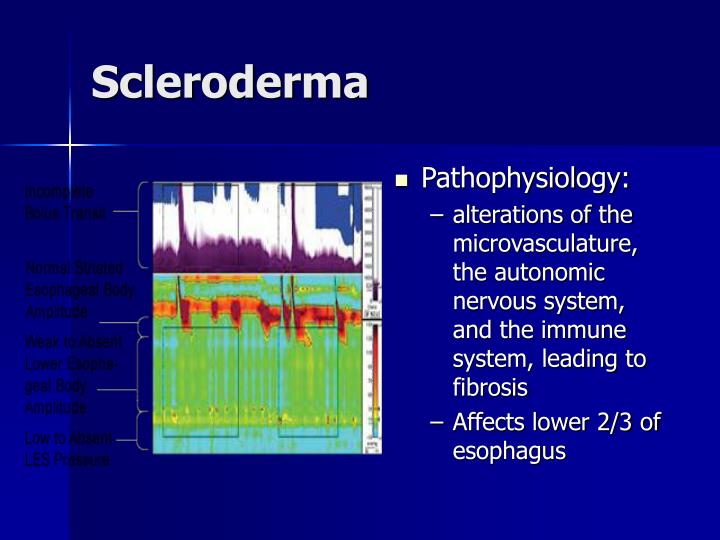 PPT - Esophageal Manometry PowerPoint Presentation - ID:381739