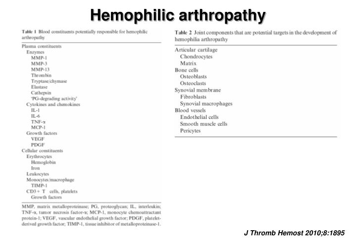 PPT - HEMOPHILIA PowerPoint Presentation - ID:382249