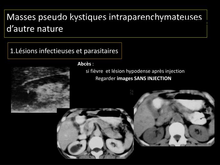 PPT - Maladies kystiques rénales PowerPoint Presentation - ID:383629