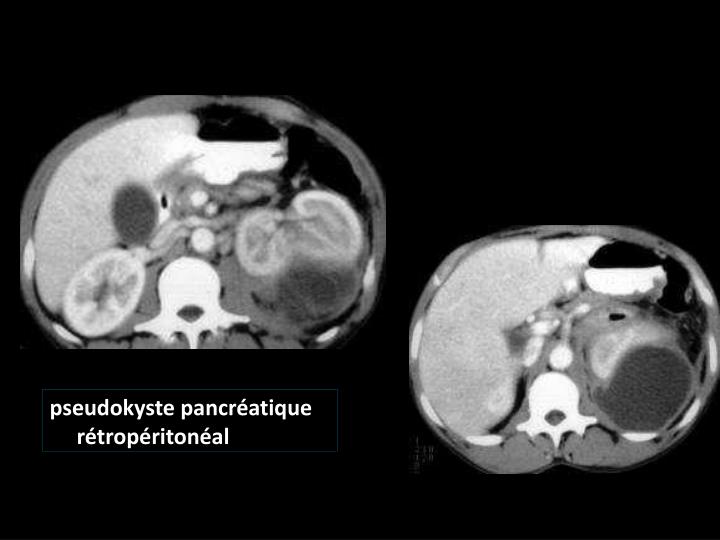 PPT - Maladies kystiques rénales PowerPoint Presentation - ID:383629