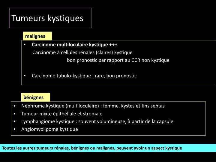 PPT - Maladies kystiques rénales PowerPoint Presentation - ID:383629