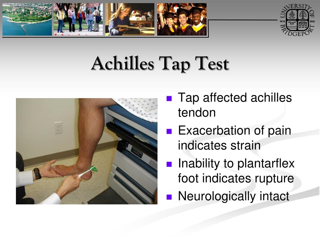 Ppt Ankle And Foot Orthopaedic Tests Orthopedics And Neurology Dx 612