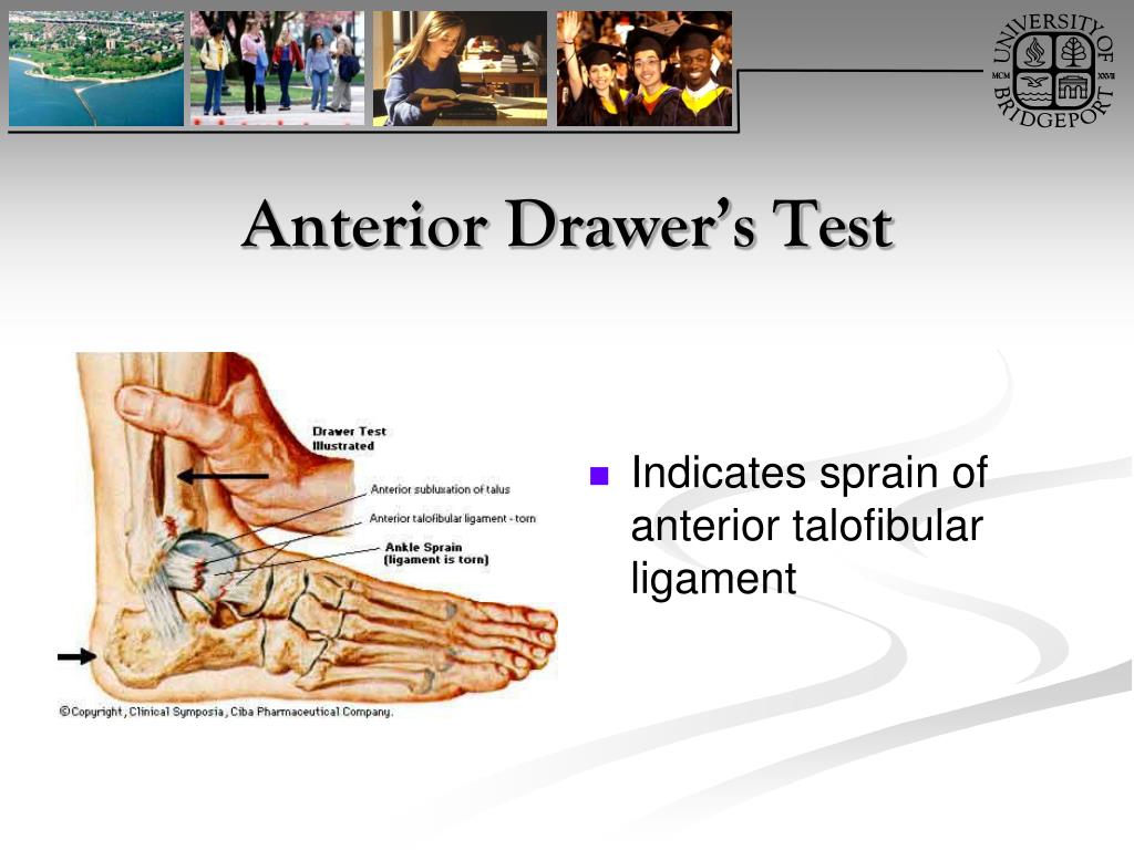 Ppt Ankle And Foot Orthopaedic Tests Orthopedics And Neurology Dx 612