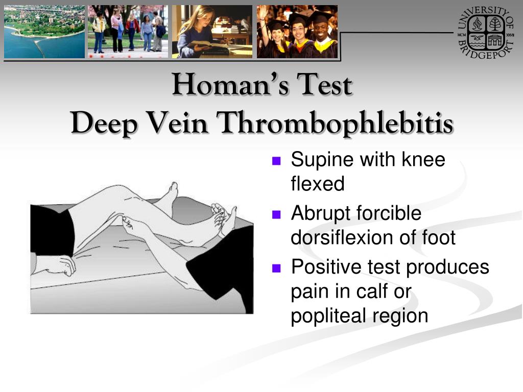 Ppt Ankle And Foot Orthopaedic Tests Orthopedics And Neurology Dx 612