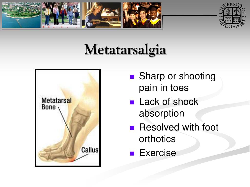 Ppt Ankle And Foot Orthopaedic Tests Orthopedics And Neurology Dx 612