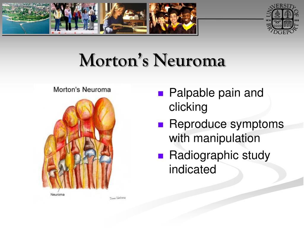 Ppt Ankle And Foot Orthopaedic Tests Orthopedics And Neurology Dx 612