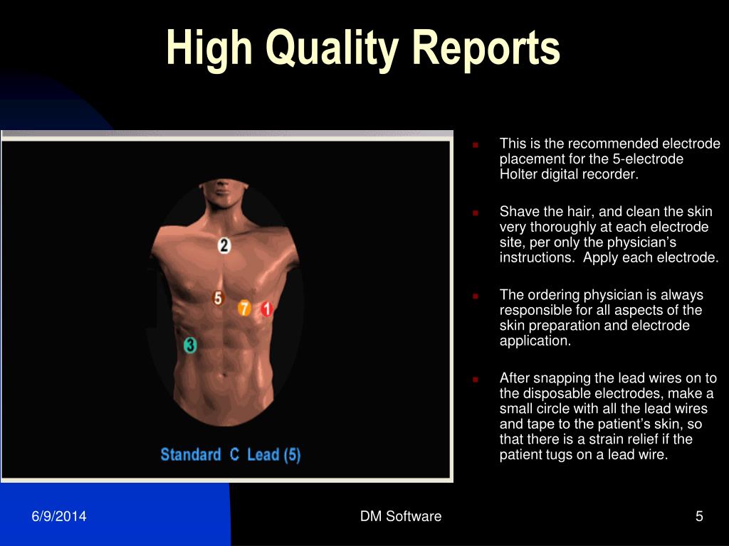 PPT - Reading the Holter ECG Report PowerPoint Presentation, free ... PPT - Reading the Holter ECG Report PowerPoint Presentation, free ...