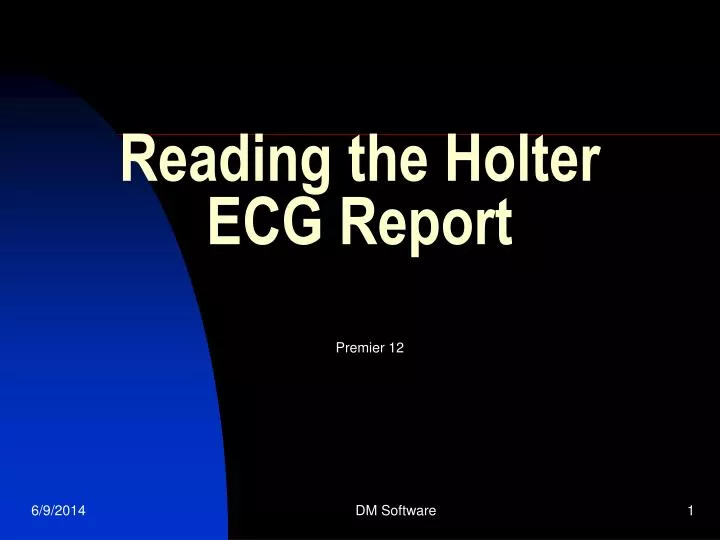 PPT - Reading the Holter ECG Report PowerPoint Presentation, free ...