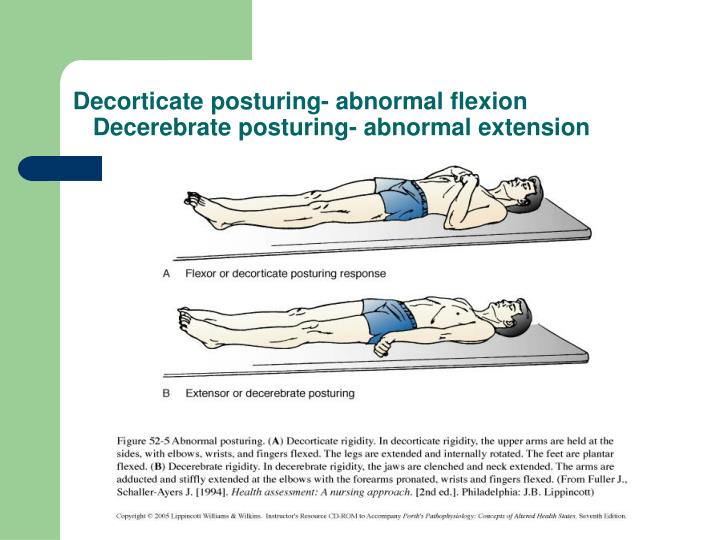 PPT - Neurosensory: Altered Cerebral Function and Increased ...