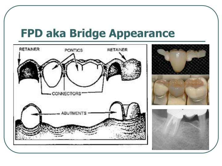 PPT - Identifying and Charting Restorations PowerPoint Presentation ...
