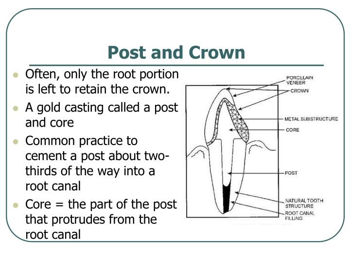 PPT - Identifying and Charting Restorations PowerPoint Presentation ...
