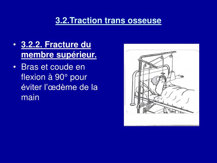 PPT - Traction- extension continue PowerPoint Presentation - ID:389064