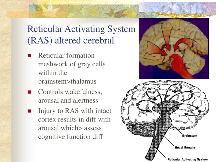 PPT - Neurosensory: Altered Cerebral Function and Increased ...