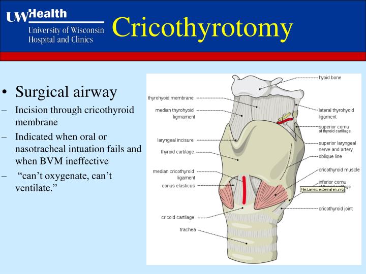 PPT - Airway Management in Trauma Trauma Conference UW Hospital and ...