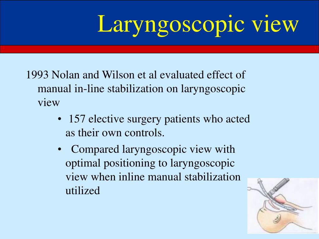 PPT - Airway Management in Trauma Trauma Conference UW Hospital and ...