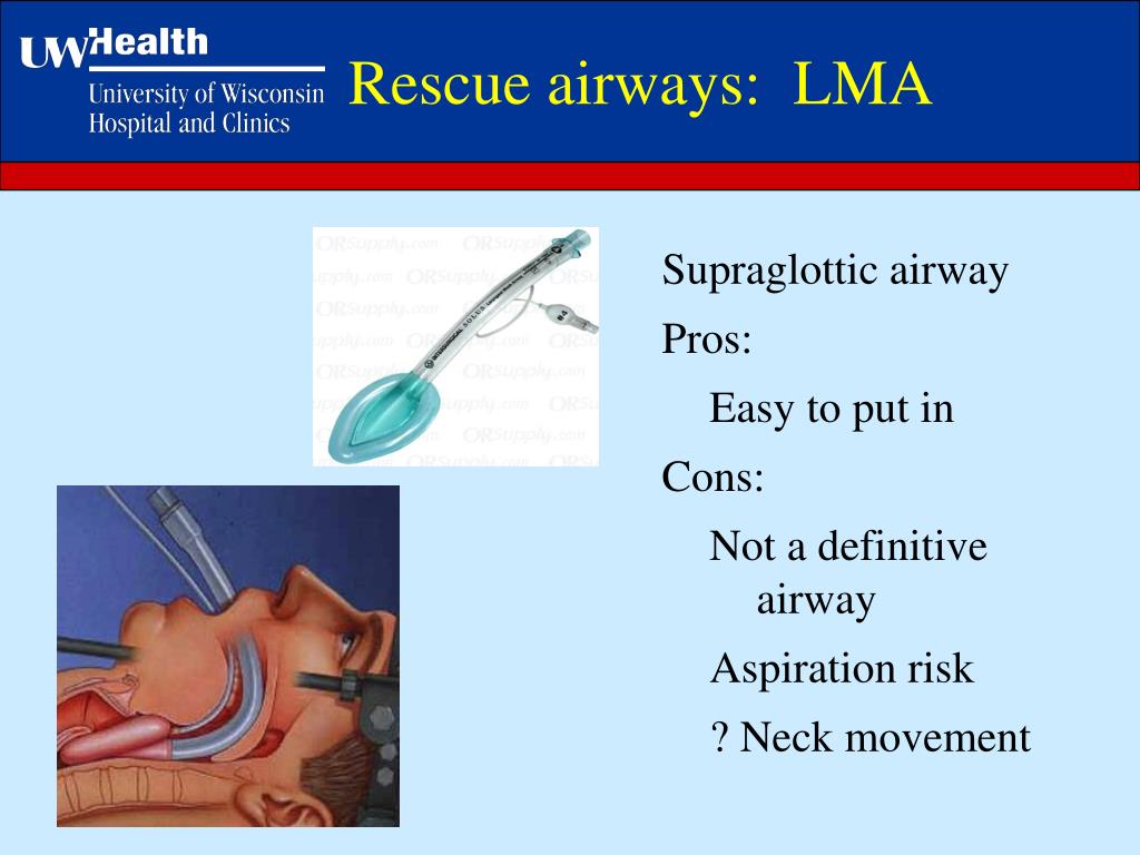 PPT - Airway Management in Trauma Trauma Conference UW Hospital and ...