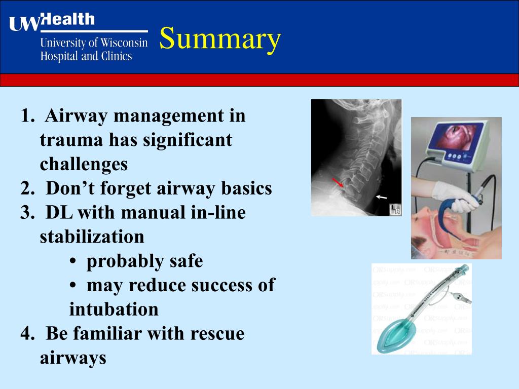 PPT - Airway Management in Trauma Trauma Conference UW Hospital and ...